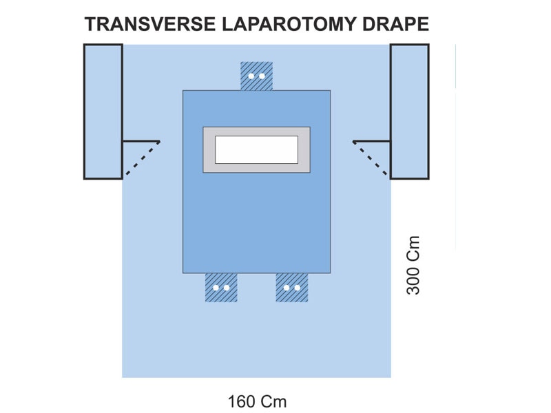 Laparotomy Procedure Draping