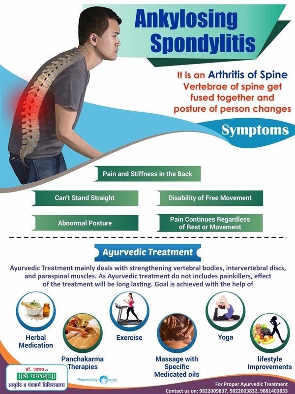Ankylosing Spondylitis Treatment